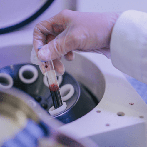 How EPAT Therapy Treatment Works | Vale Medical